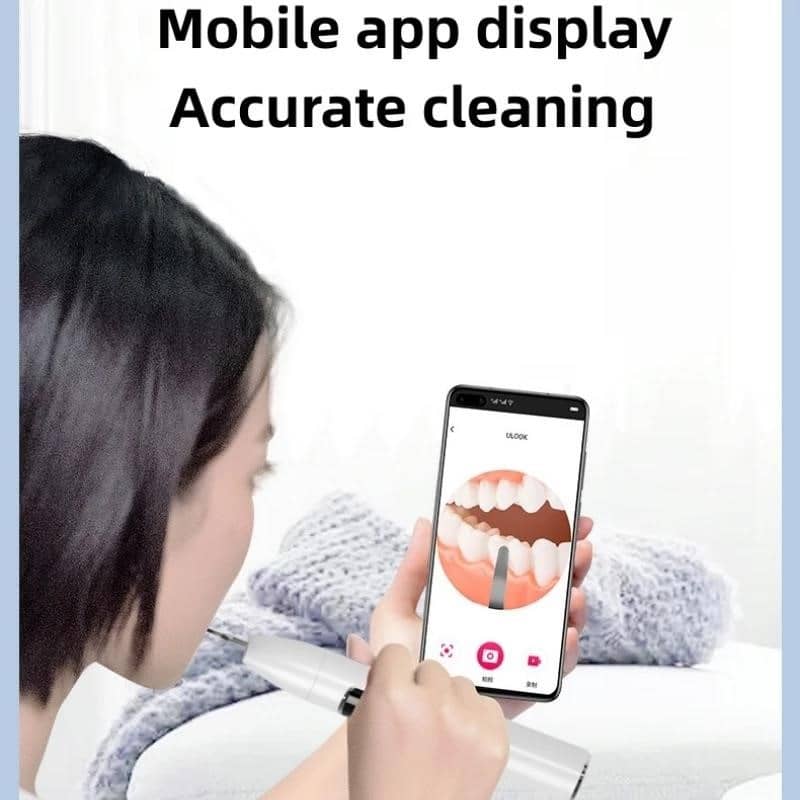 Xiaomi Visual Ultrasonic Dental Calculus Remover Teeth Plaque Scaler ...