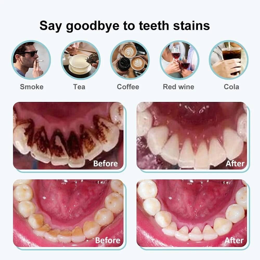 Електрически Sonic Dental Calculus Scaler Oral Teeth Премахване на ...