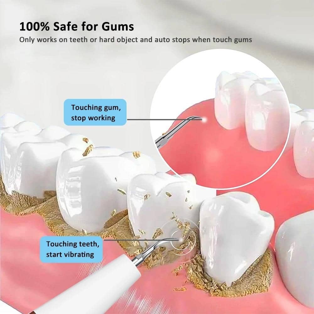 Електрически Sonic Dental Calculus Scaler Oral Teeth Премахване на ...