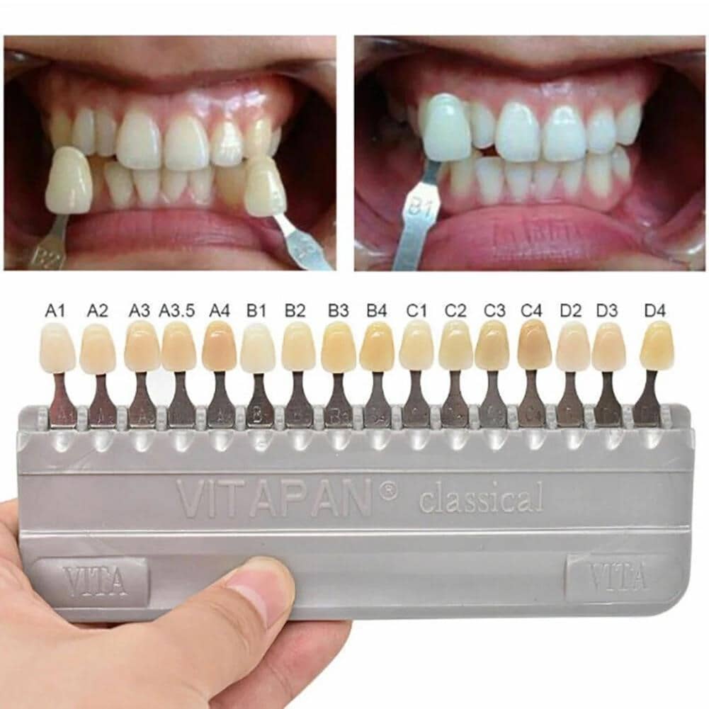 16 цвята A1-D4 VITA Classical Dental Bleach Shade Guide Избелване на зъби Порцеланов водач за ...
